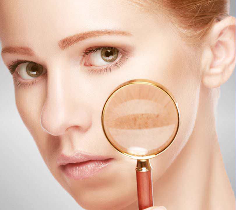 What Does Your Skin Discoloration Say?